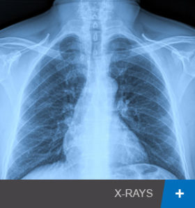 MDI Medical Diagnostic Imaging